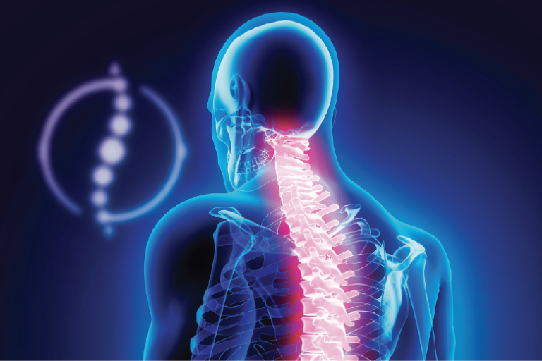 Department of Spine Surgery – Epic Multispecialty Hospital